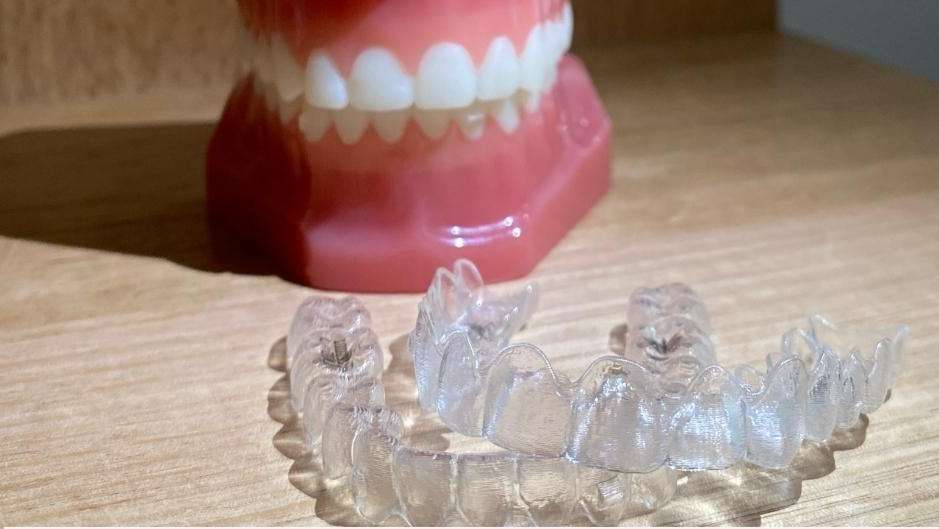 Have you been thinking about straightening your teeth? | Smile ...